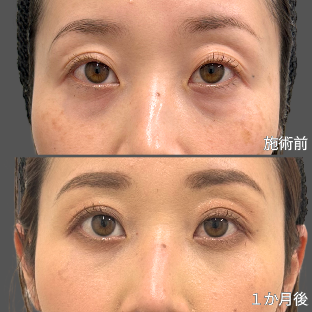 ラクレクリニック｜渋谷のバレない自然な美容医療