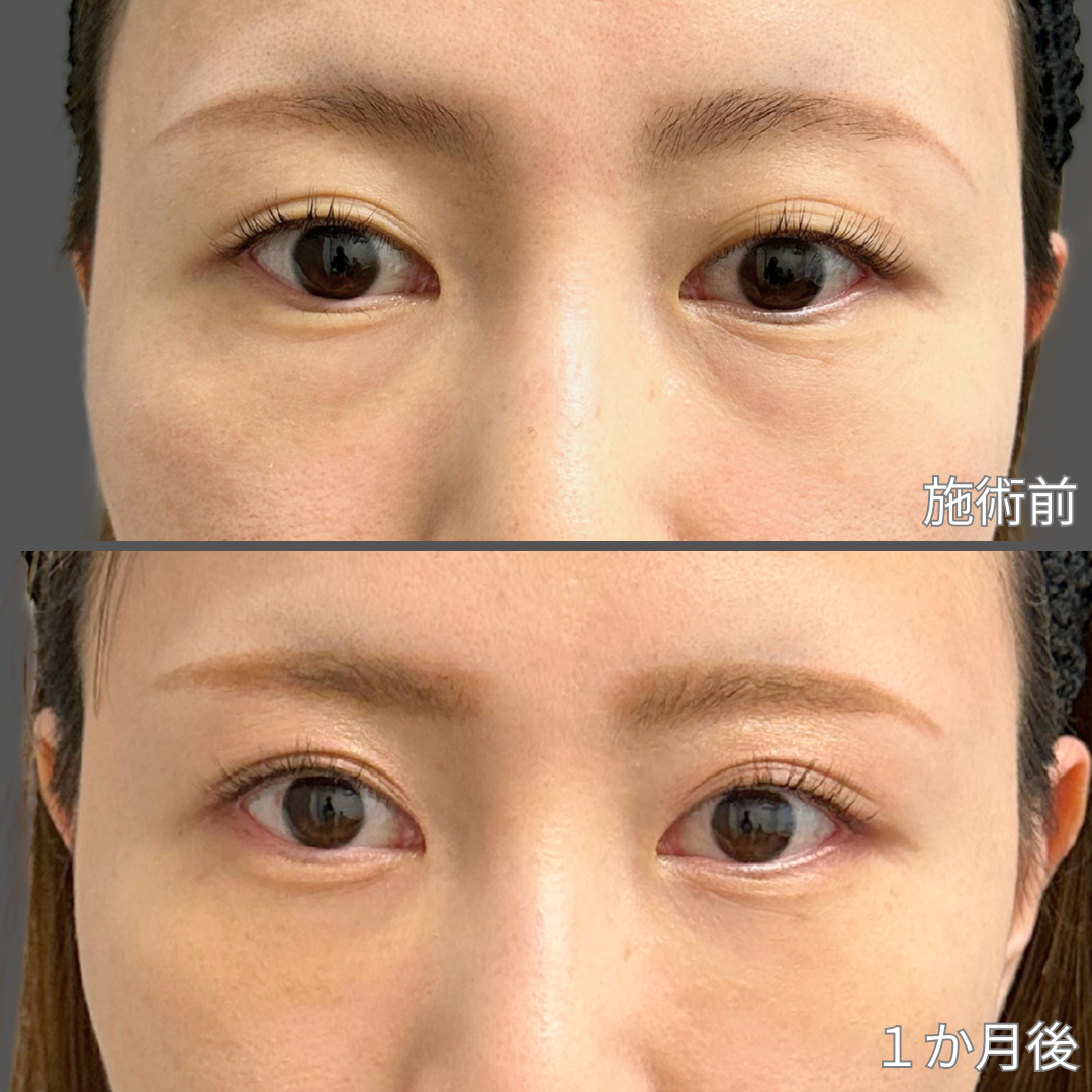 ラクレクリニック｜渋谷のバレない自然な美容医療