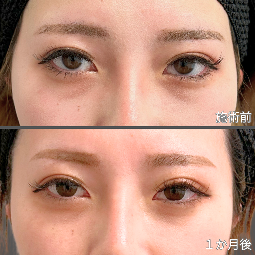 ラクレクリニック｜渋谷のバレない自然な美容医療