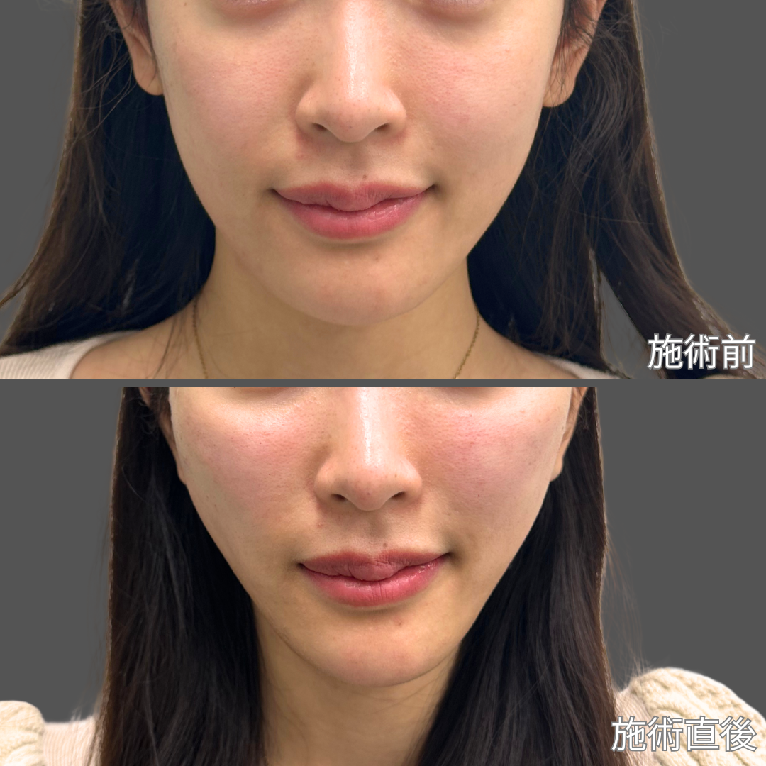 ラクレクリニック｜渋谷のバレない自然な美容医療