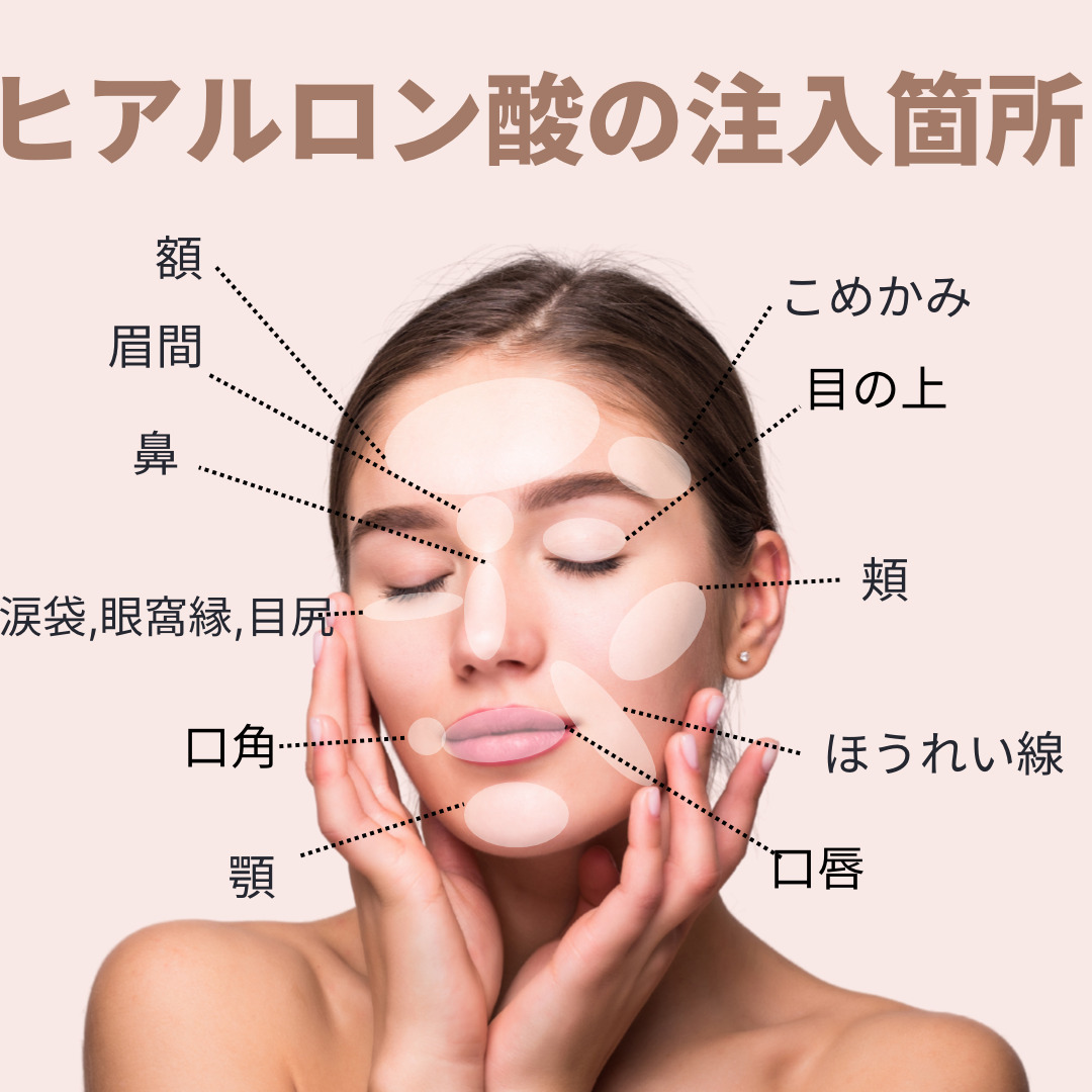 ヒアルロン酸注入 - ラクレクリニック